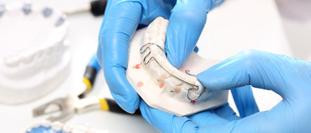 What Are Arch Wires in Orthodontics? Stages, Types, & More